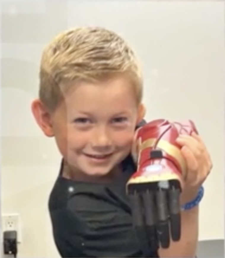 Bionic Arm Gives 5-Year-Old Boy a New Lease on Life - MHTN